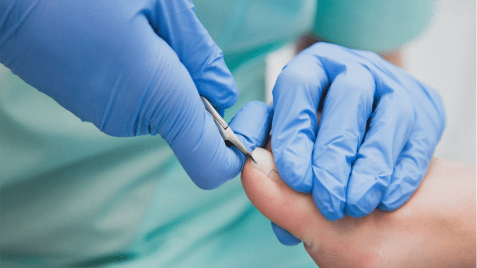 Why Do Ingrown Toenails Keep Coming Back? | Fall Creek Foot & Ankle